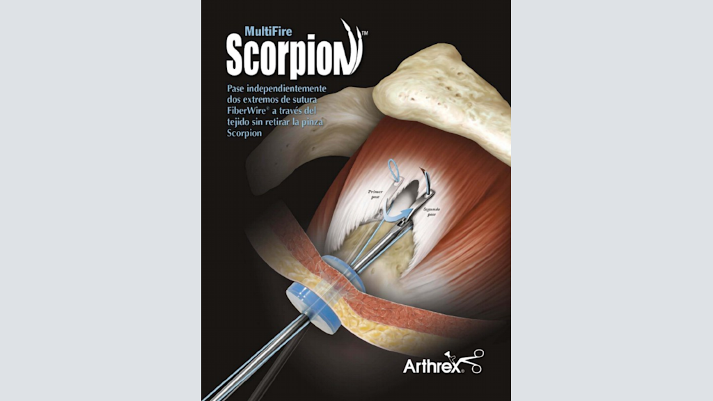Arthrex - Scorpion™ Suture Passers
