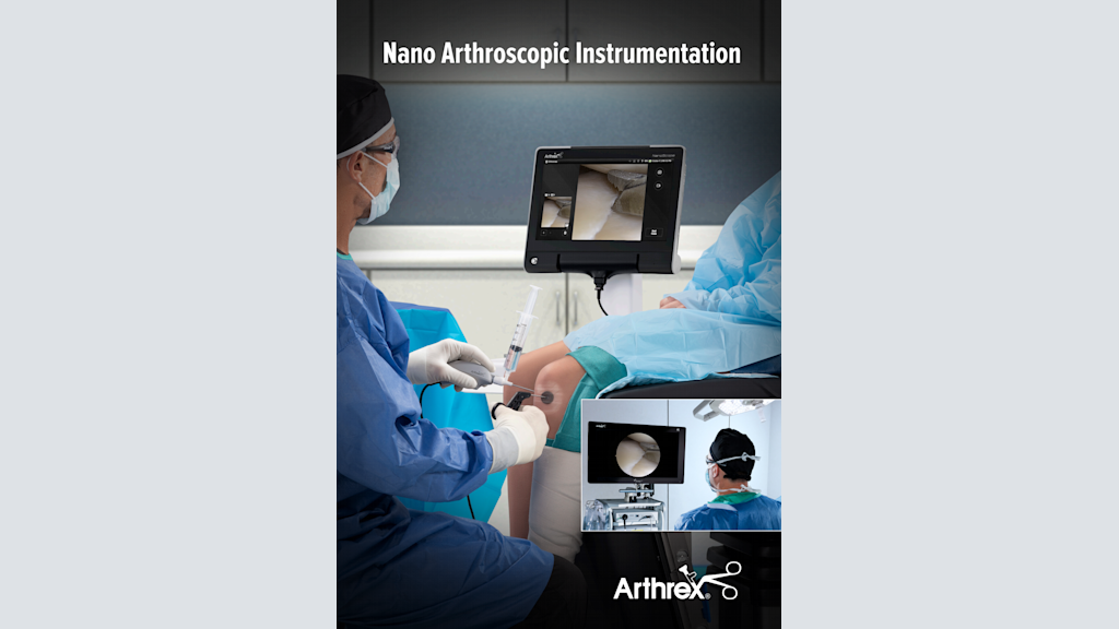 Arthrex - Nano Arthroscopy Instrumentation