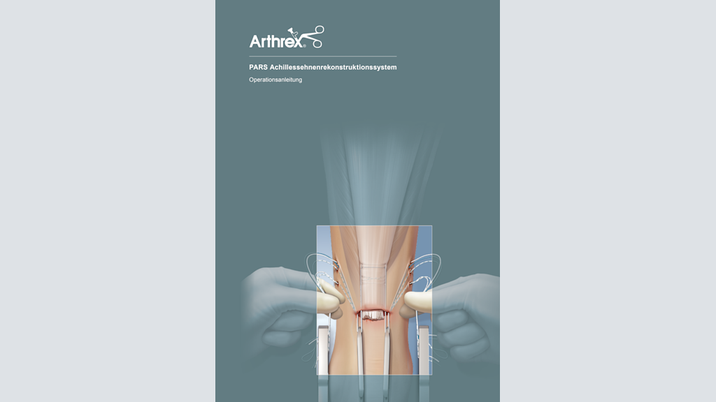 Arthrex - PARS sistema de gabarito para tendão de Aquiles