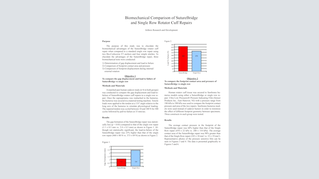 Arthrex - Corkscrew® FT Technique