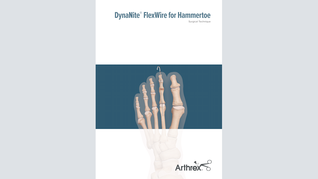 Arthrex - DynaNite® FlexWire