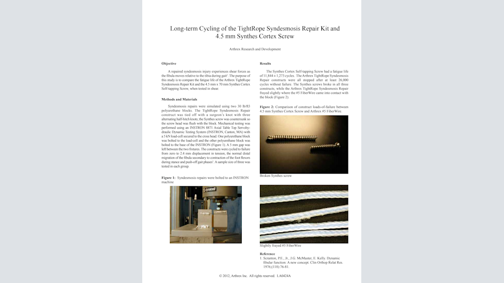 Arthrex - Syndesmosen-TightRope® XP-Implantatsystem