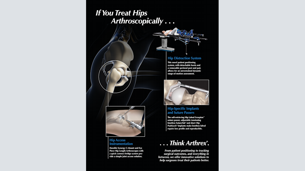 Arthrex - Hip Distraction System