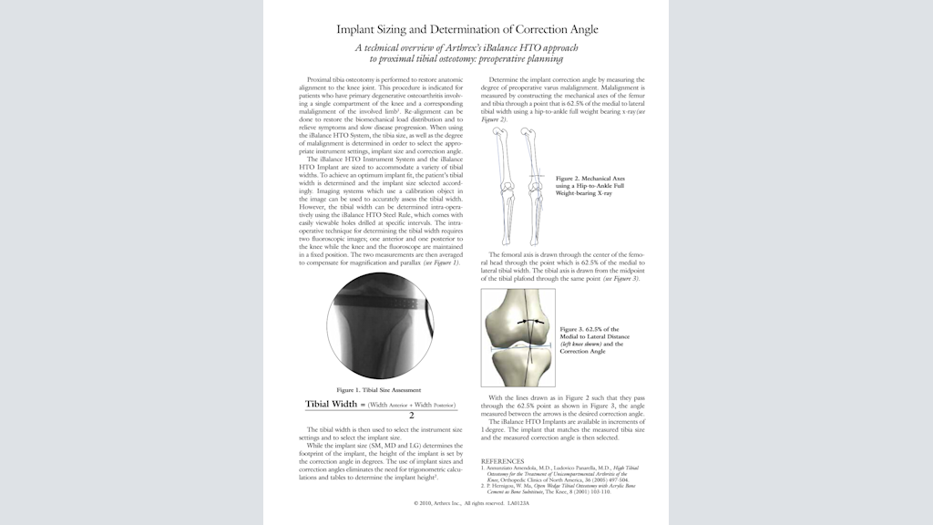 Arthrex - Tibial Opening Wedge