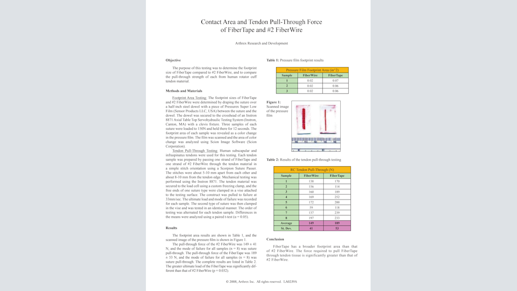 Arthrex - FiberWire® and TigerWire® Sutures