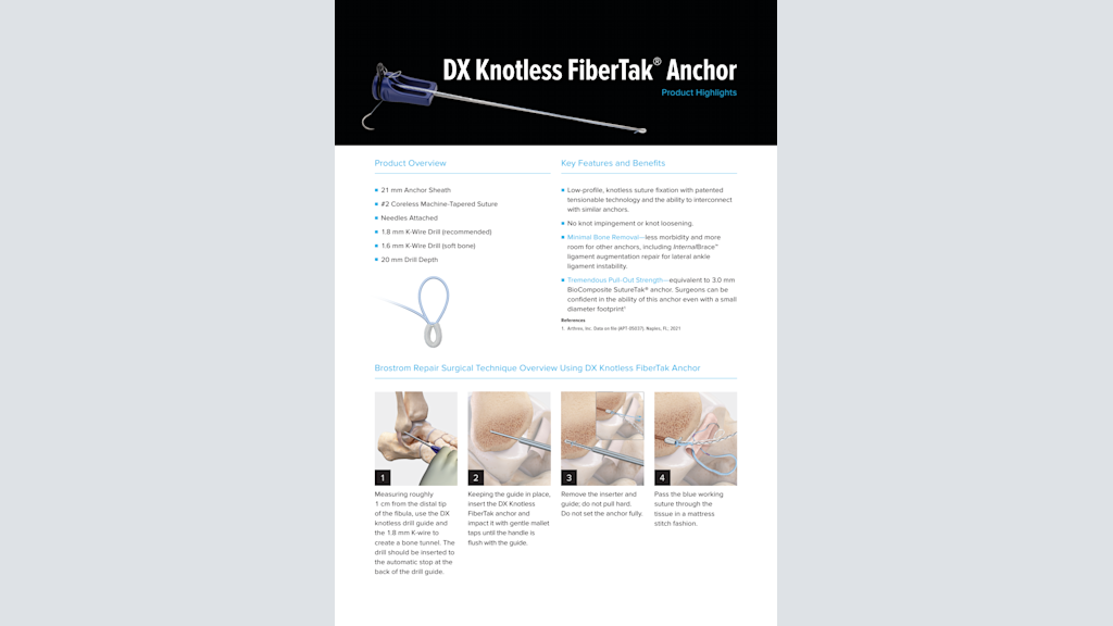 Arthrex - DX Knotless FiberTak®