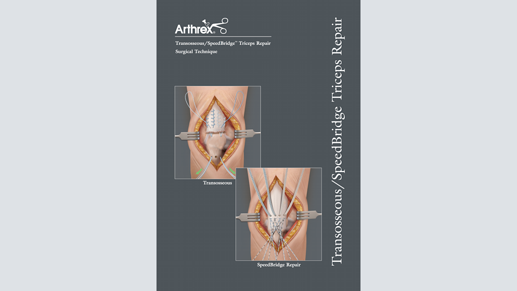 Arthrex - Triceps Technique