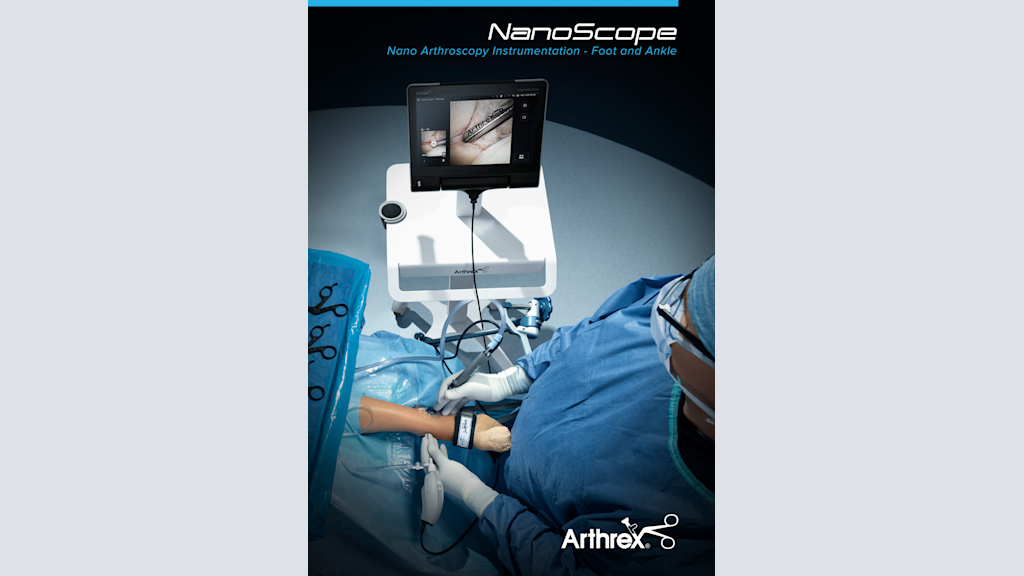 Arthrex - Nano Arthroscopy for Foot and Ankle