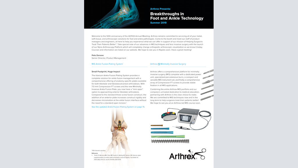 Arthrex - FDL Implant System