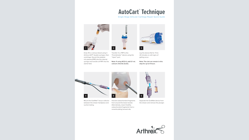 Arthrex - AutoCart™