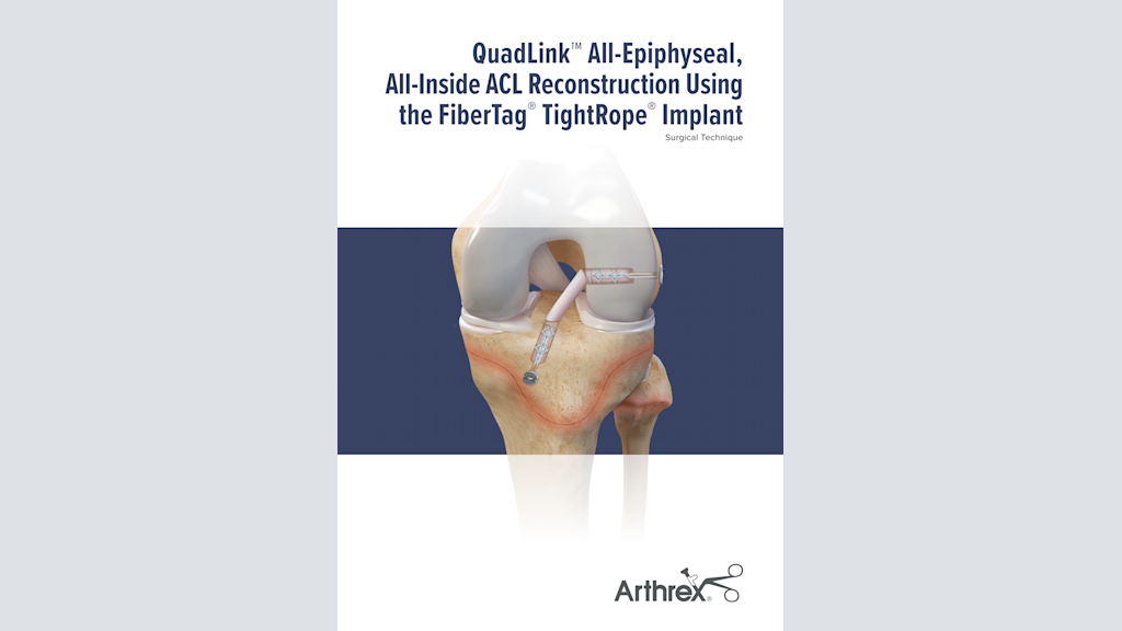 Arthrex - FiberTag® TightRope® Implant