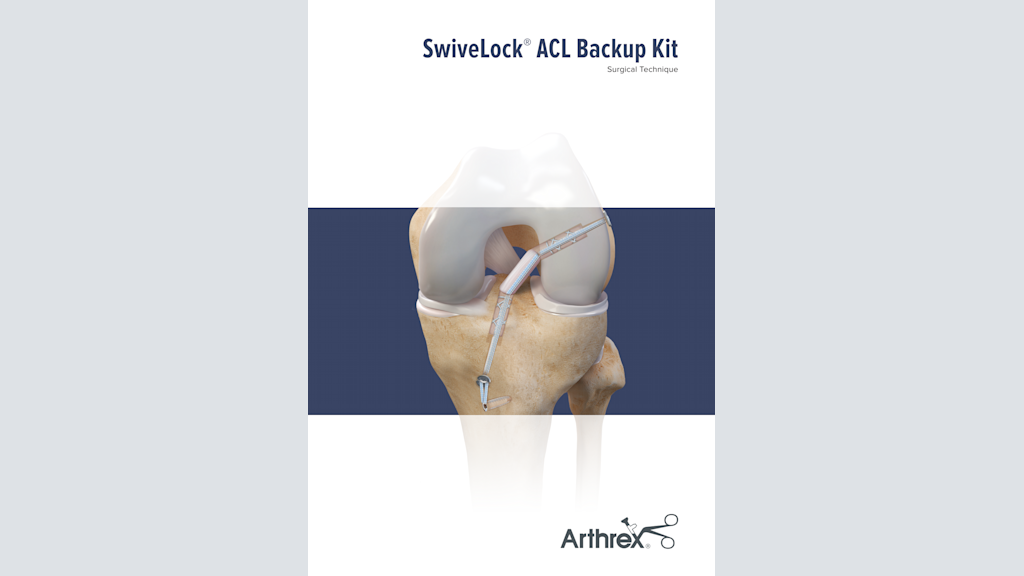 Arthrex - ACL Backup Fixation System