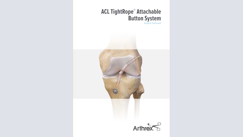 Arthrex - TightRope® II Attachable Button System Arthrex - TightRope® II Attachable Button System