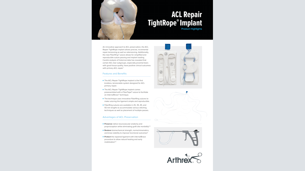 Arthrex - Repair TightRope®-Implantat mit FiberRing™-Fäden