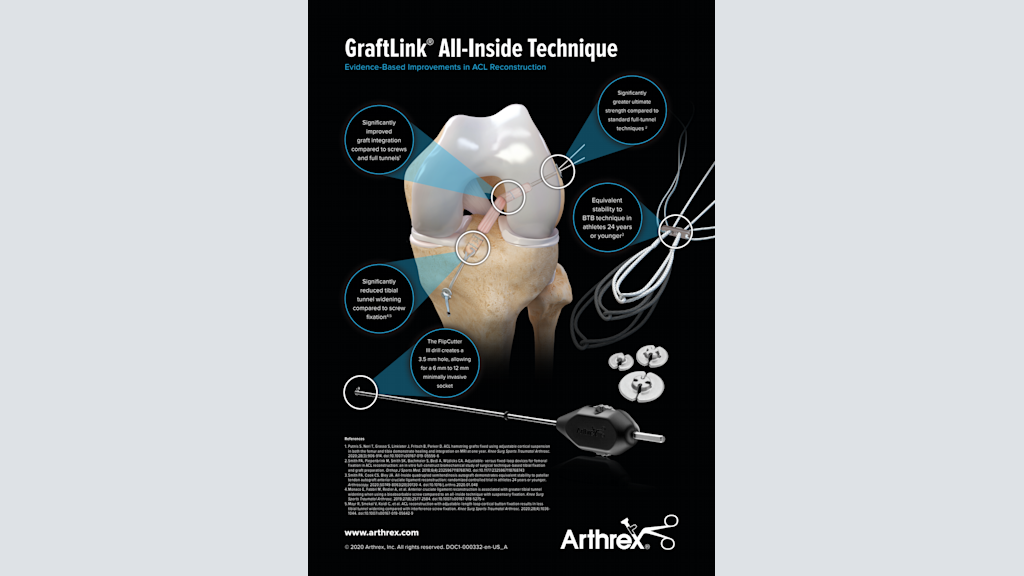 Arthrex - GraftLink®-Technik