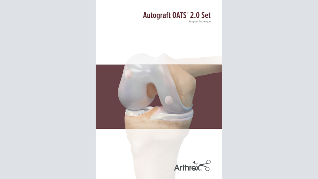 Arthrex - OATS® para autoinjerto