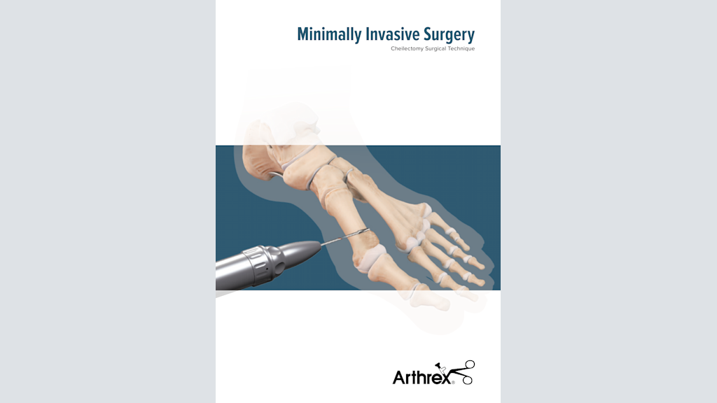Arthrex - Minimally Invasive Surgery
