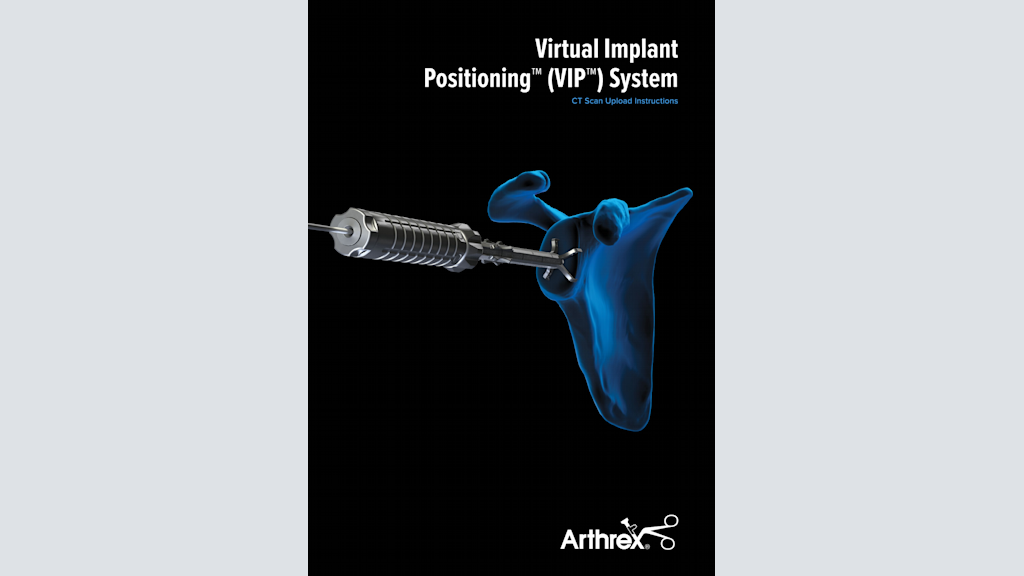 Arthrex - Virtual Implant Positioning™ (VIP™) System