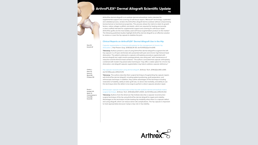 Arthrex - ArthroFLEX® zellfreies dermales Allograft