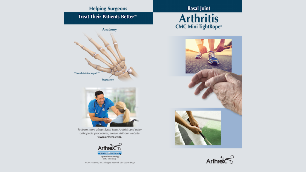 Arthrex - Mini TightRope®