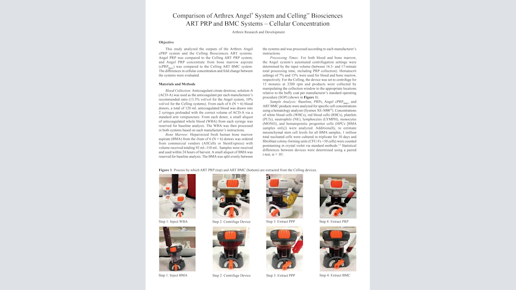 Arthrex - Angel® System