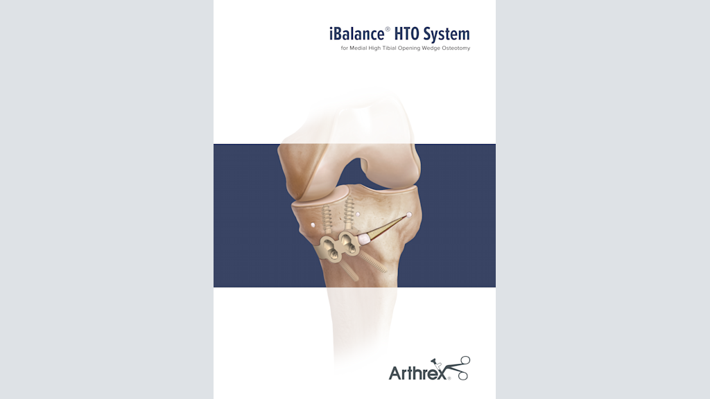 Arthrex - iBalance® HTO Surgical Technique