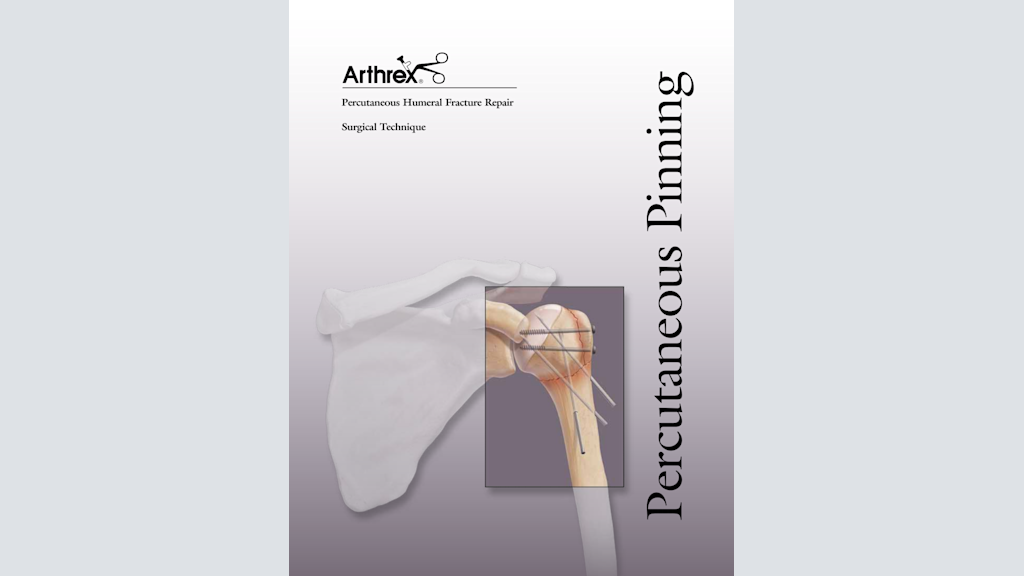 Arthrex - Percutaneous Pinning Technique