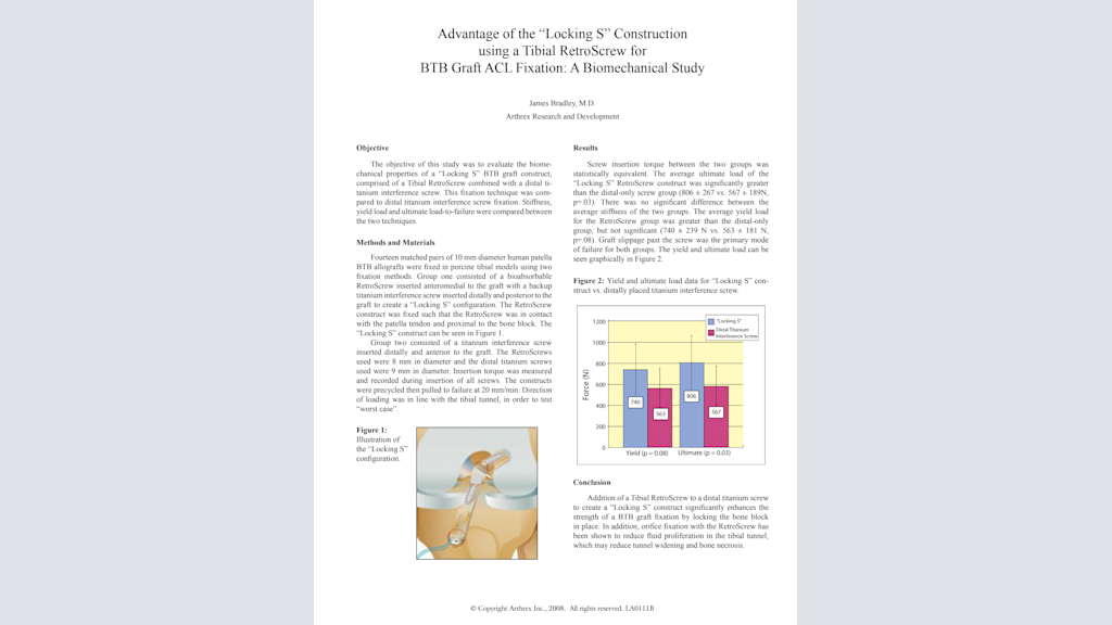 Arthrex - BTB Autograft ACL Reconstruction