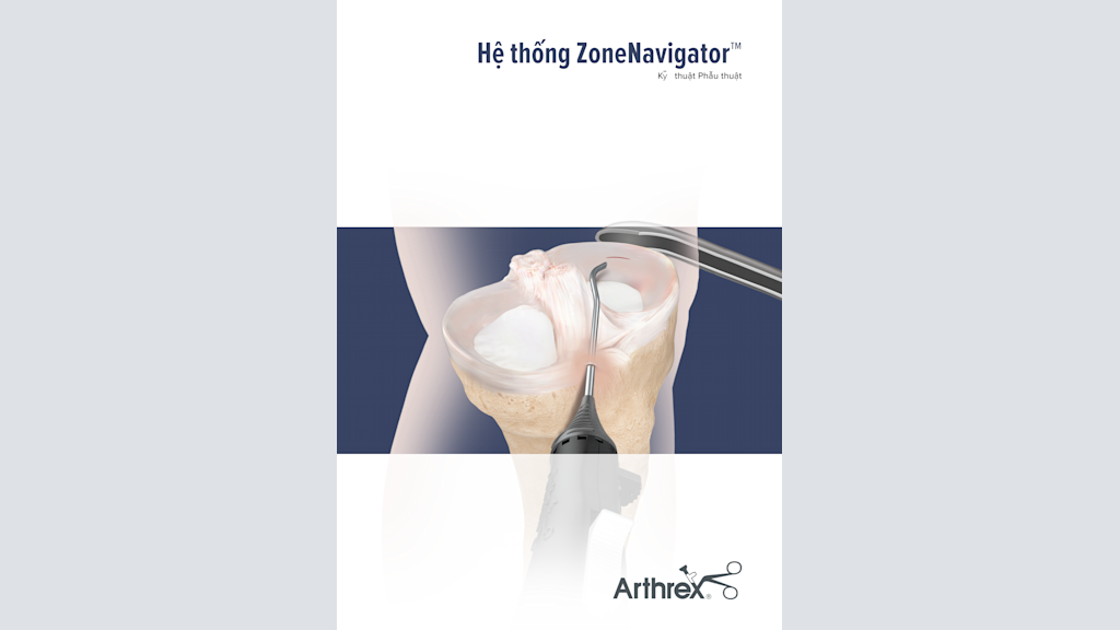 Arthrex - Das ZoneNavigator™-System