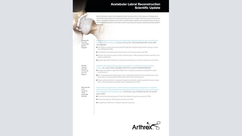Arthrex - Labral Fixation