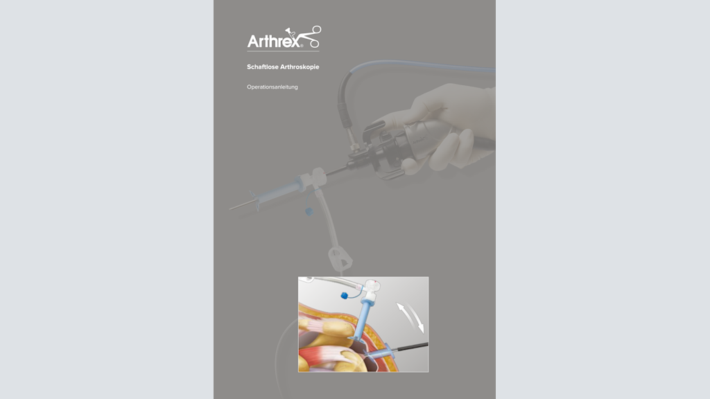 Arthrex - PassPort Button™ Cannula
