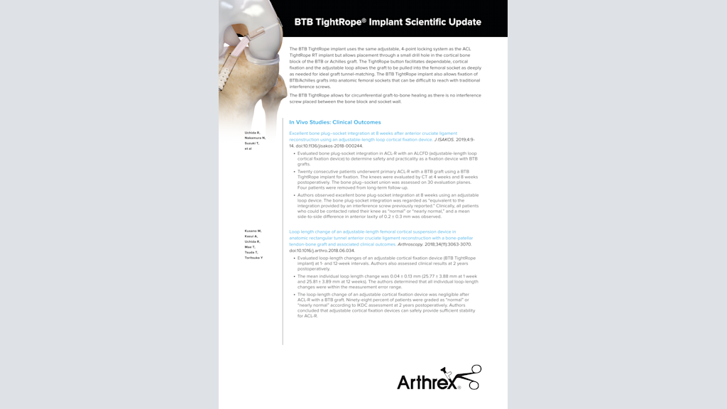 Arthrex - TightRope® II BTB Implant