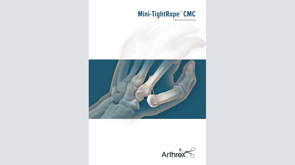 Arthrex - Mini TightRope® CMC Technique
