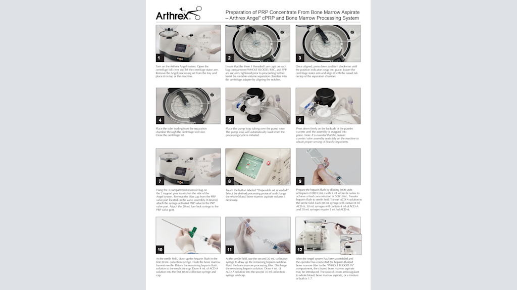 Arthrex - Angel® System