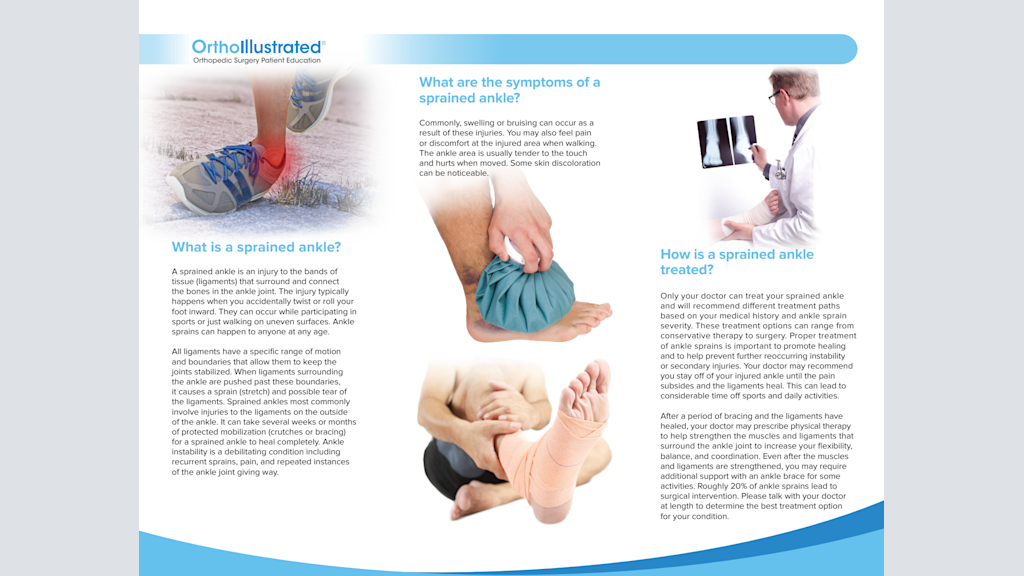Arthrex - Técnica de reparación de Brostrom con InternalBrace™