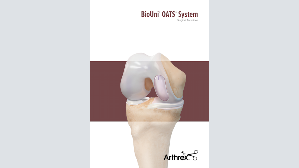 Arthrex - BioUni® OATS® Instrument Set