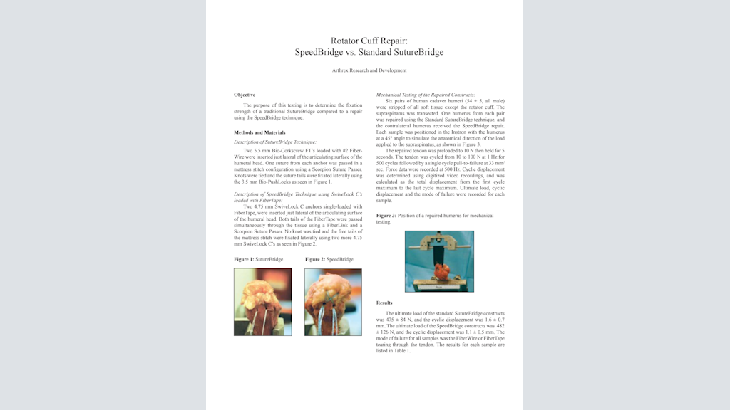 Arthrex - SwiveLock® C Anchor