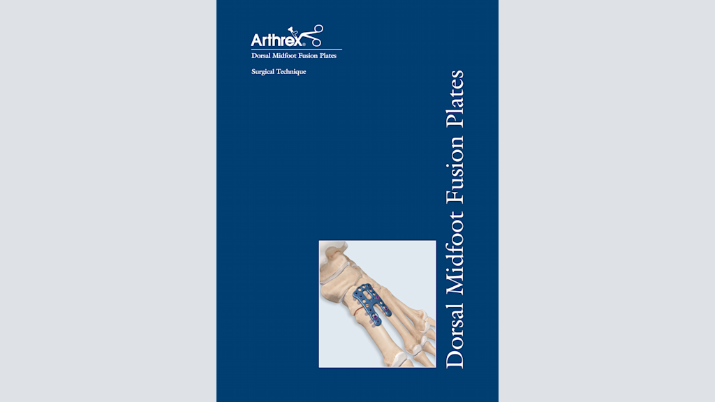 Arthrex - Lisfranc Plates