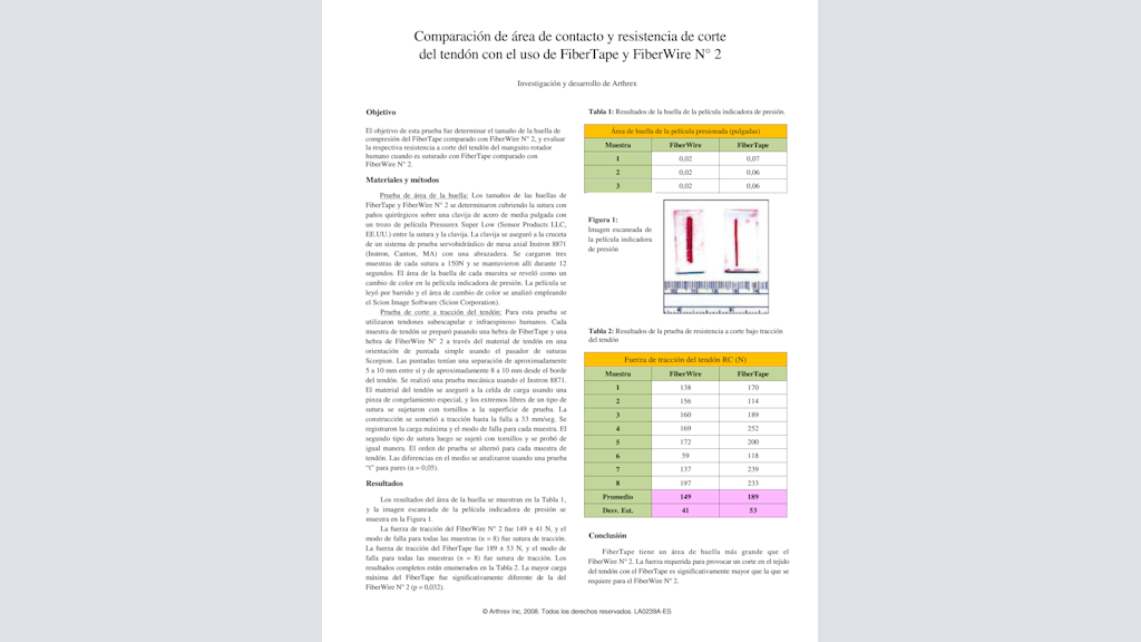 Arthrex - SpeedFix™ Single Row Technique