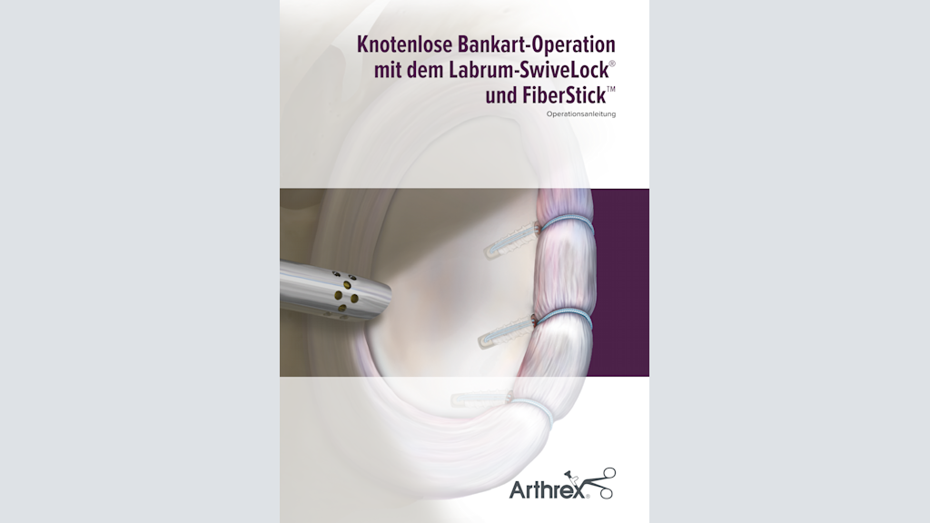 Arthrex - FiberStick™ and TigerStick®