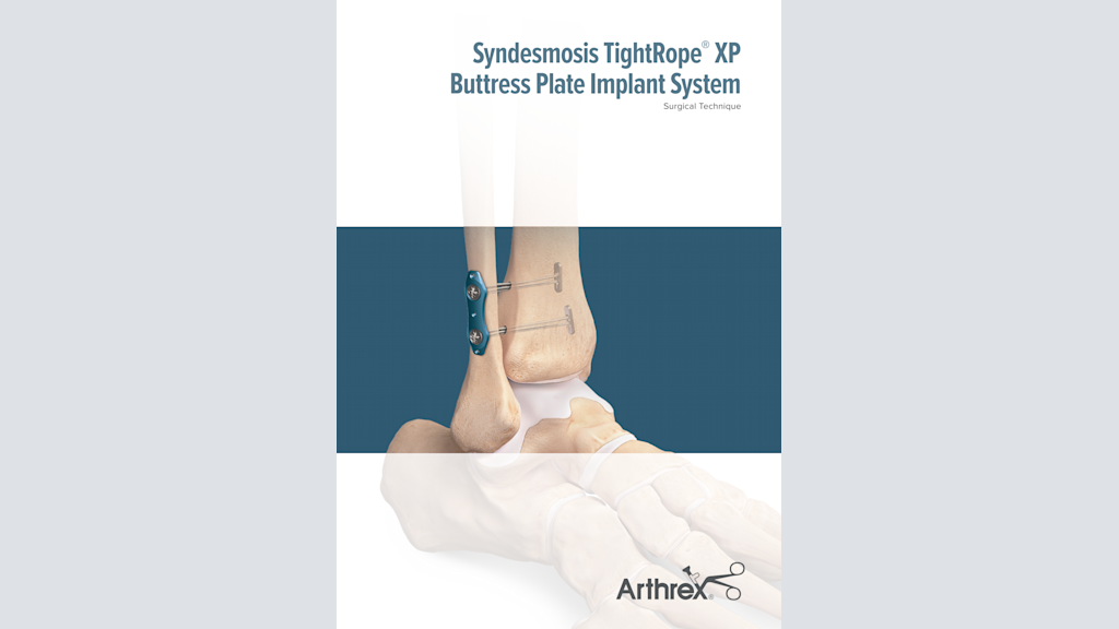 Arthrex - Syndesmosis TightRope® XP Implant System