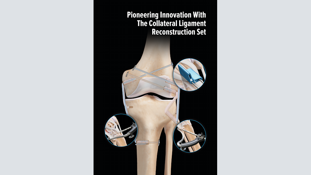 Arthrex - Collateral Ligament Reconstruction Set