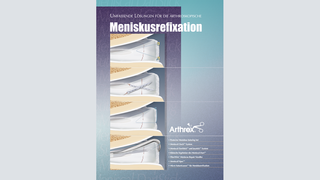 Arthrex - Meniscal Cinch