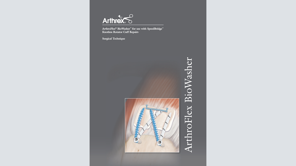 Arthrex - SwiveLock® C Anchor