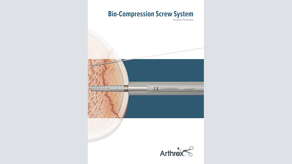Arthrex - Bio-Compression Screws