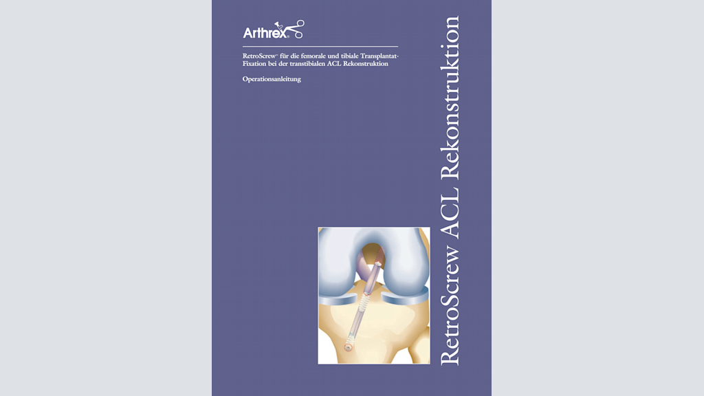 Arthrex - Transtibiale ACL-Rekonstruktion