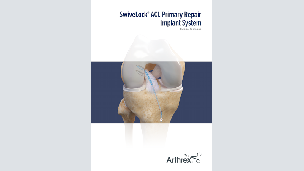 Arthrex - ACL Repair