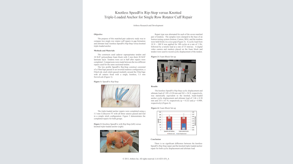 Arthrex - SpeedFix™ Single Row-Technik