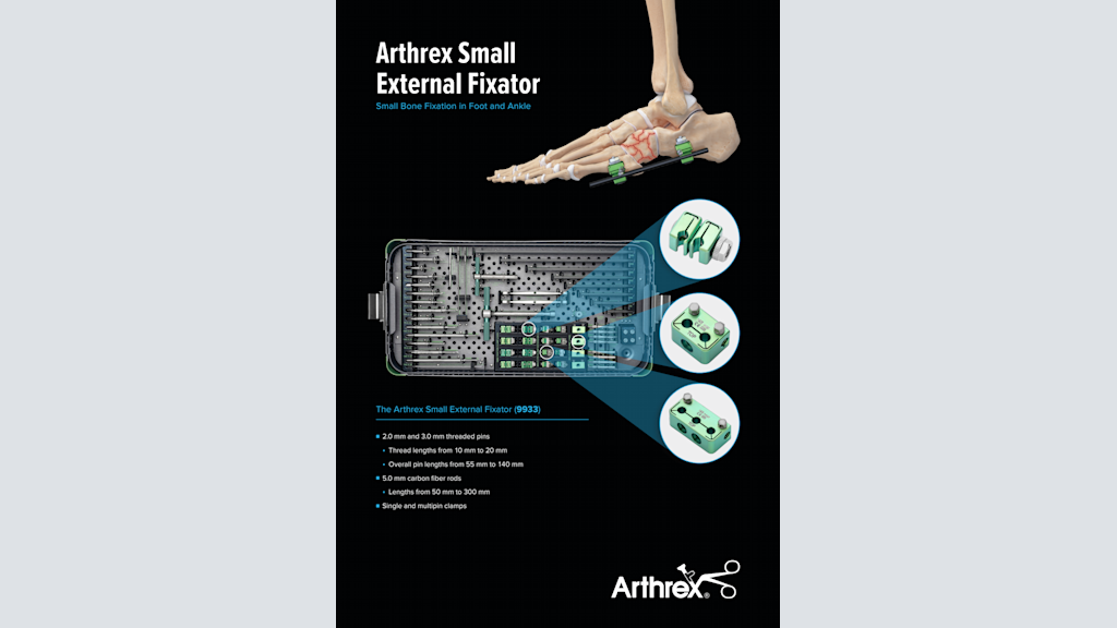 Arthrex - Small External Fixator