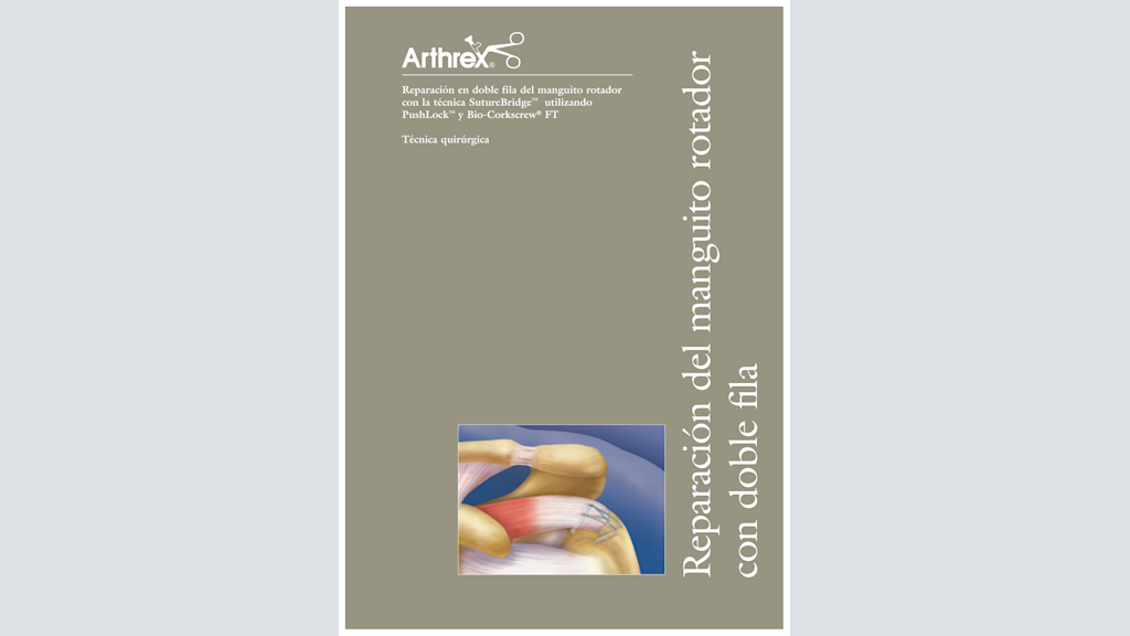 Arthrex - Scorpion™ Suture Passers